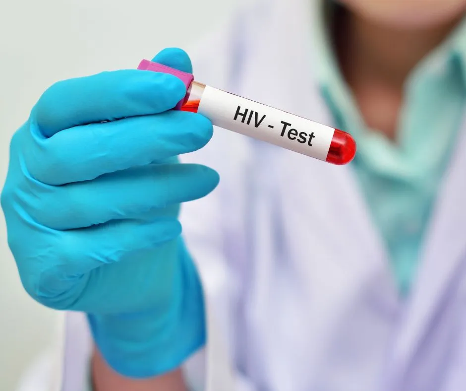 OPS aclara que no existe una epidemia de VIH en RD - MundoSaludRDN.ONLINE